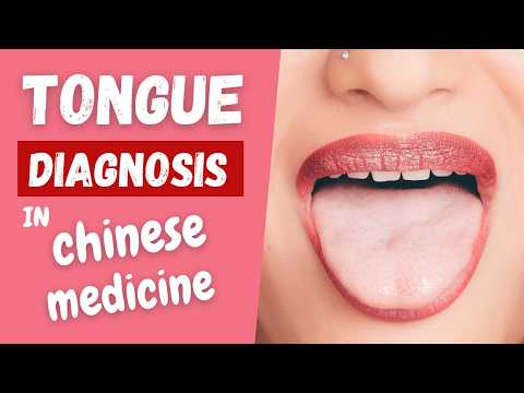Tongue Diagnosis in Chinese Medicine
