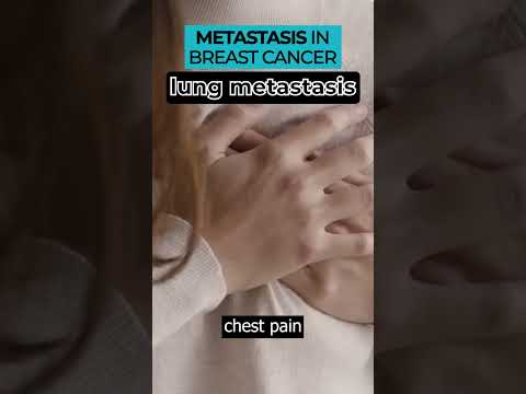 Discover the common sites of breast cancer metastasis and their symptoms ๐๏ธ๐ฌ