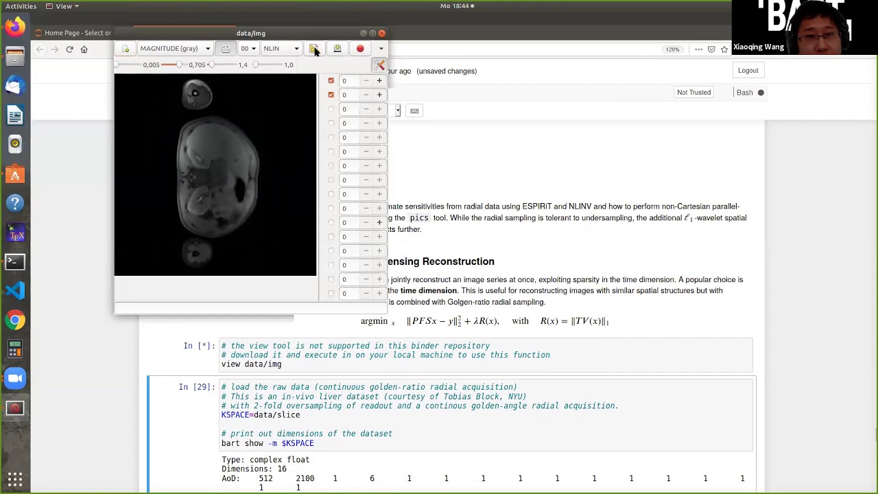 BART Webinar #1 Day 1 Part 3: GRASP-like MRI reconstruction