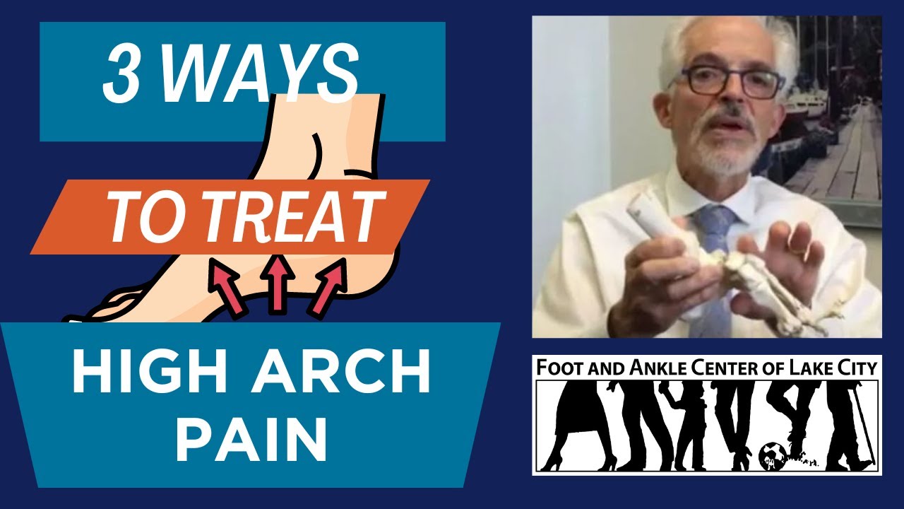 3 Ways To Treat Foot Pain If You Have High Arches | Foot and Ankle ...