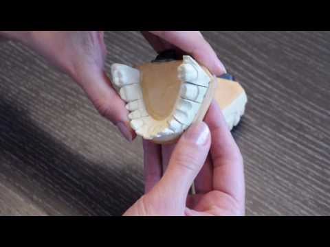 Open technologies Dental scanner