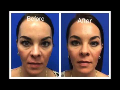 Media | Arslanian Plastic Surgery