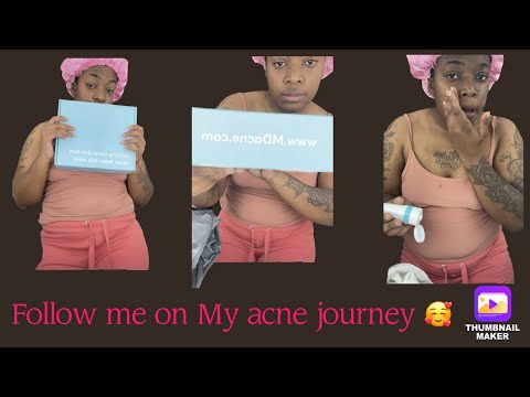 MD ACNE REVIEW Follow me on my acne journey will give y’all another update in 3 weeks ‼️
