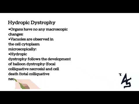 Parenchymal Dystrophy: Classifications