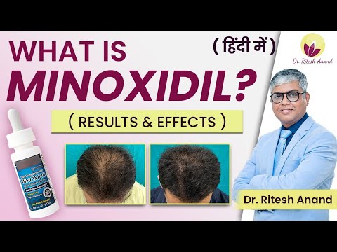Minoxidil Finasteride Topical Solution - Minoxidil Finasteride Solution ...