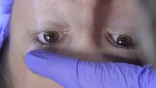 NREMT Skillset/Pupil Evaluation