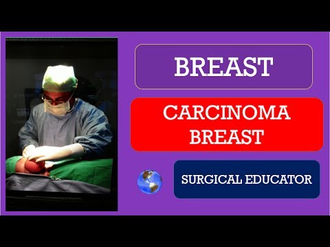 CARCINOMA BREAST-- How To DIAGNOSE & TREAT/Breast Pathologies