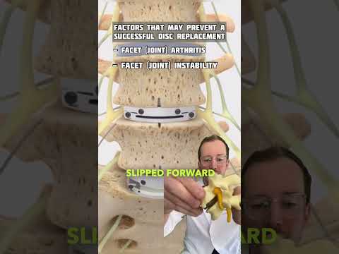 Lumbar Disc REPLACEMENT Doโs and Dontโs