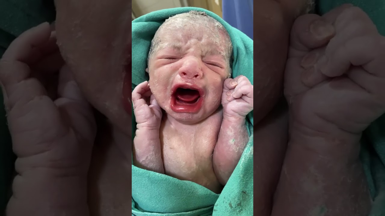 Loud crying baby |##love #babies #newborn #cryingbaby #cutebaby #drpoonammaggo