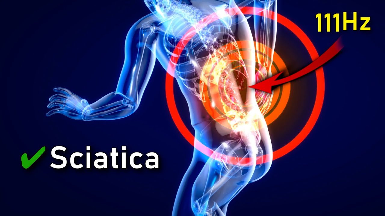IT'S HERE ❯❯❯ The Sciatica 