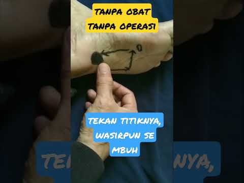 tanpa obat ,cukup tekan titiknya. wasir sembuh #wasirsembuh #shorts #shortsvidio #lukiafandi