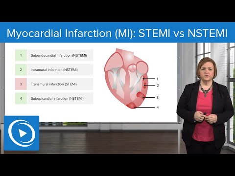Myocardial Infarction (MI): STEMI vs NSTEMI – Med-Surg Nursing | Lecturio Nursing