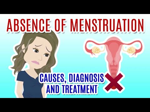AMENORRHEA or Absence of Menstruation