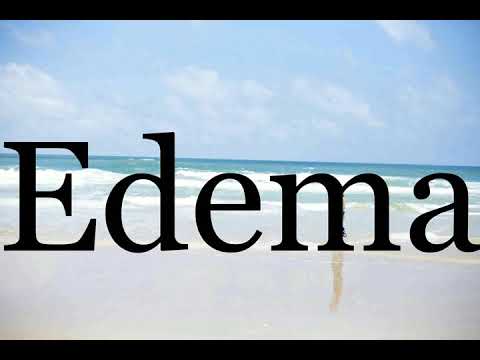 How To Pronounce Edema🌈🌈🌈🌈🌈🌈Pronunciation Of Edema