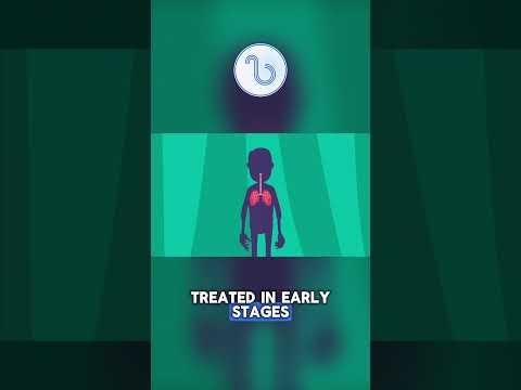 Lung Cancer Screening for COPD Patients 🏥 | Early Detection Saves Lives!