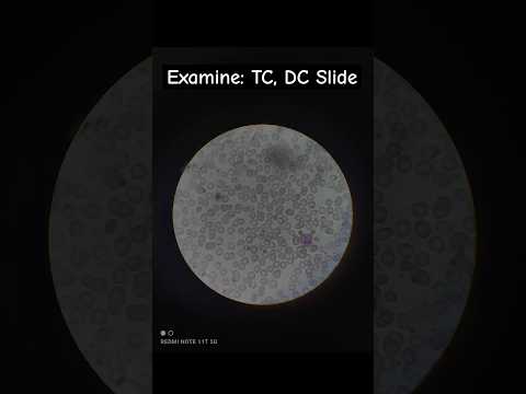 TC DC slide microscopic examination ll Total count and differential count of WBC #microscope #vial