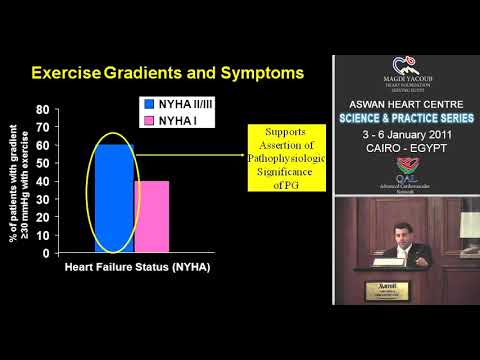 Significance of LV Outflow Tract Obstruction in HCM