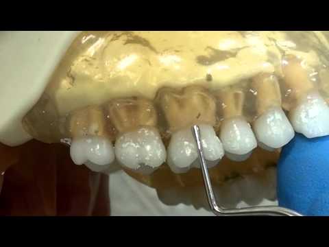 How to Use Dental Files