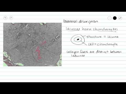 Fibrocartilage (Fibrous cartilage) Connective Tissue