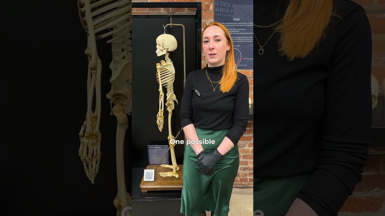 Examining Klippel-Feil syndrome