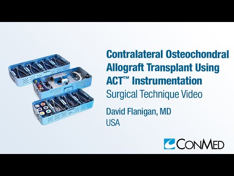 Dr. David Flanigan - Contralateral OC Allograft Transplant Using ACT™ Instrumentation - CONMED