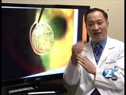Ming Wang, MD, Ph.D - Amniotic membrane contact lens story - Ch 2/ABC
