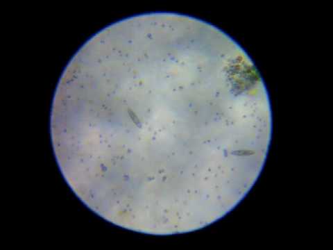 20170125171531