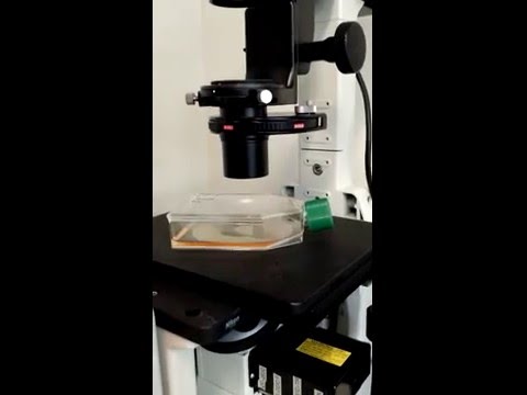 Cancer cells under fluorescent microscope