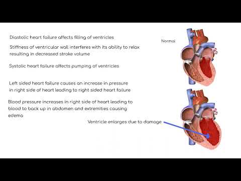 Pathophysiology: Heart Failure
