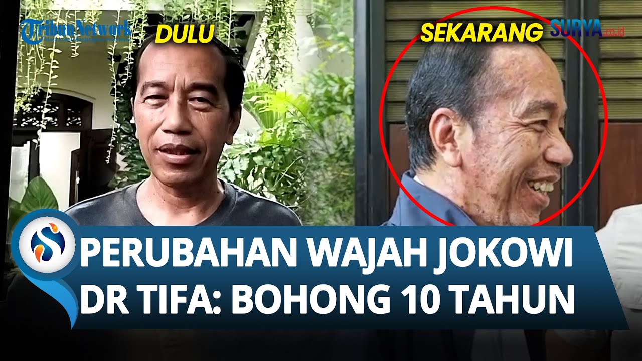 Wajah Jokowi Penuh Flek Hitam di Tengah Kasus Ijazah Disorot Dokter ...