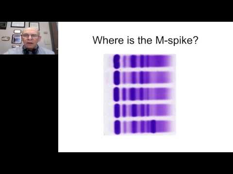 David Keren - M-protein Evaluation in an Age of Automation ...