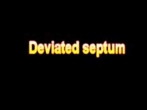 What Is The Definition Of Deviated septum - Medical Dictionary Free Online