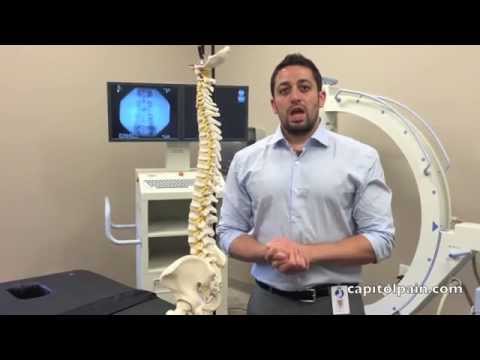 Epidural steroid injections