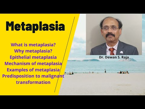 Metaplasia Q & A