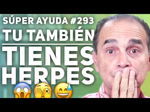SÚPER AYUDA #293 Tu También Tienes Herpes