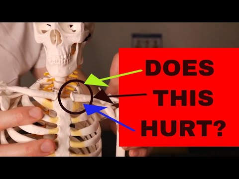 QUICK RELIEF! How to heal a sternoclavicular joint sprain explained