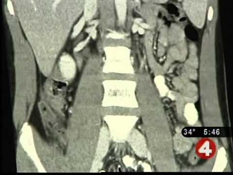 Are CT scans for children safe?