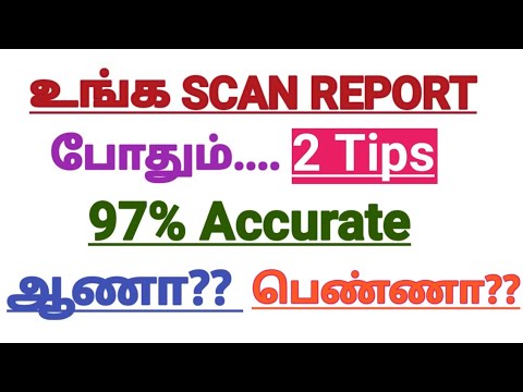 How to find Baby Gender by using Scan Report ||Ramzi's Theory || 97% Accurate || Pregnancy Tips