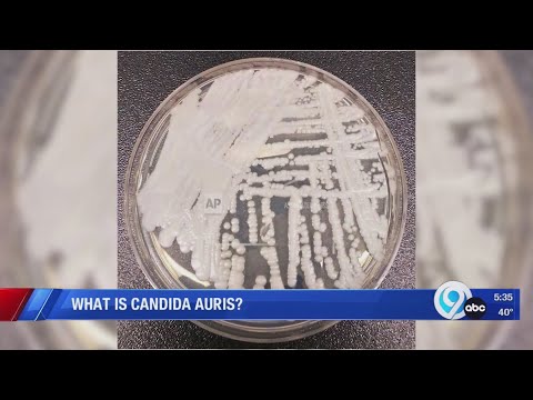 What is Candida Auris? and how does it spread?