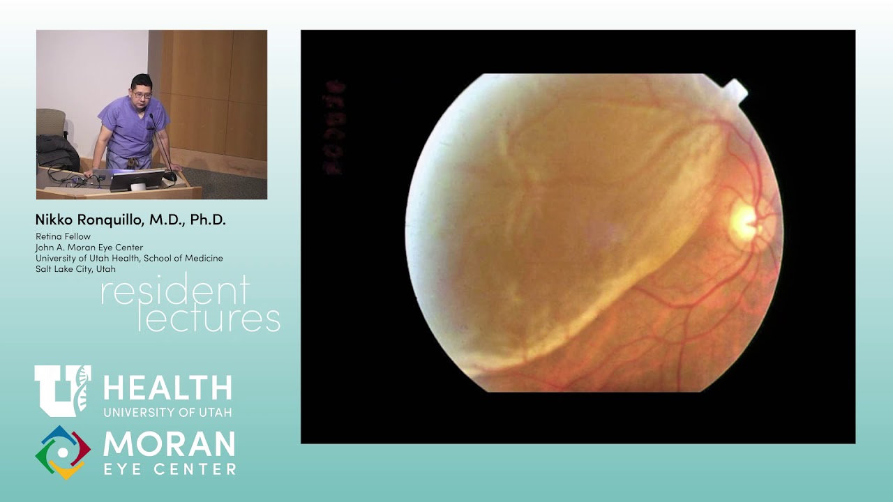 OKAP Review: Retina [ARCHIVE]