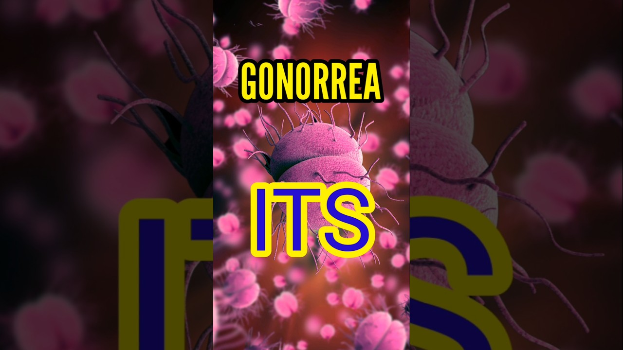 GONORRHEA #curiosities #science #hospital #science #diseases #health #laboratory