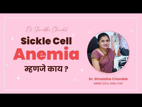 Dr. Shraddha Chandak on Sickle Cell Anemia | Explanation in Marathi | Pediatric Haemato-Oncologist
