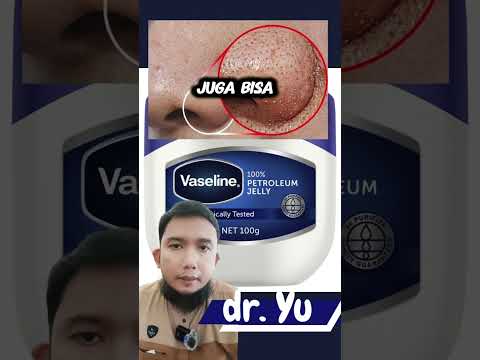 Pakai Vaseline Malah Muncul Komedo
