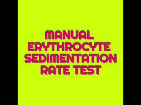 Erythrocyte sedimentation rate test (ESR) #infection #medical #viralshorts #laboratory