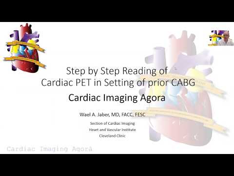 Cardiac PET in Setting of prior CABG