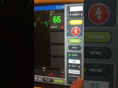 Transcutaneous Pacing