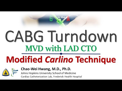 LAD CTO with modified Carlino in CABG turndown