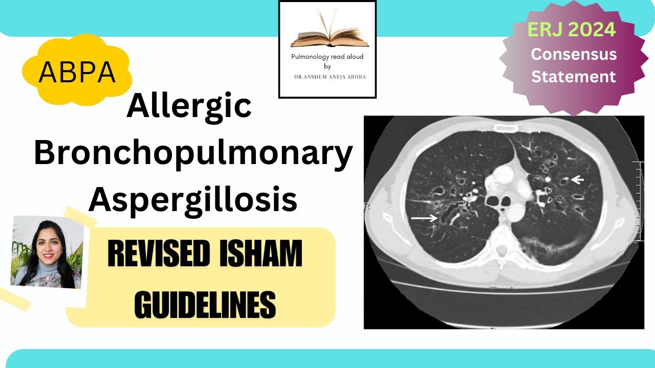 ABPA guidelines 2024: Revised ISHAM consensus