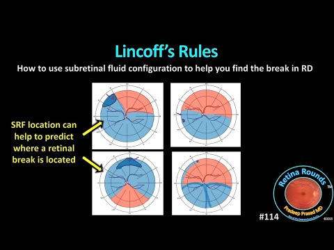 RetinaRounds™ 114: Lincoff's Rules