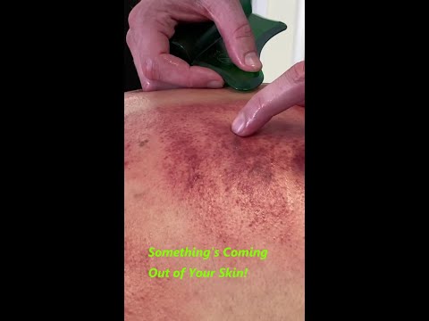 Something's Coming Out of His Skin!😲 PRICELESS Reaction - check out full video for more... #shorts